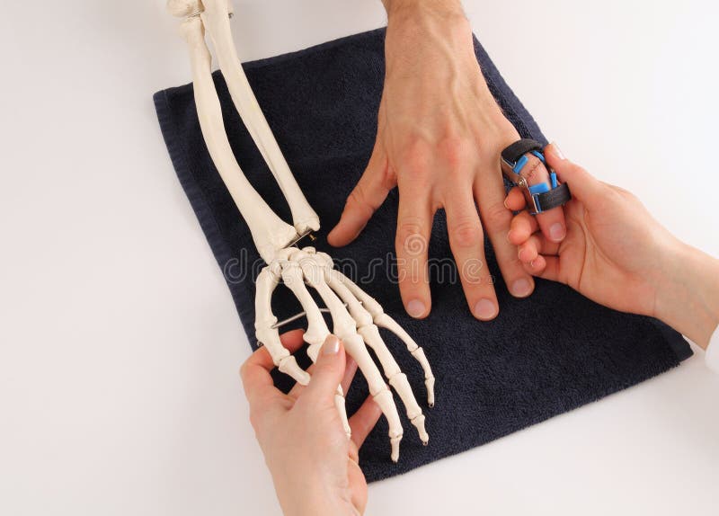 Hand Surgeon with Skeleton Hand at Patient Stock Photo - Image of ...