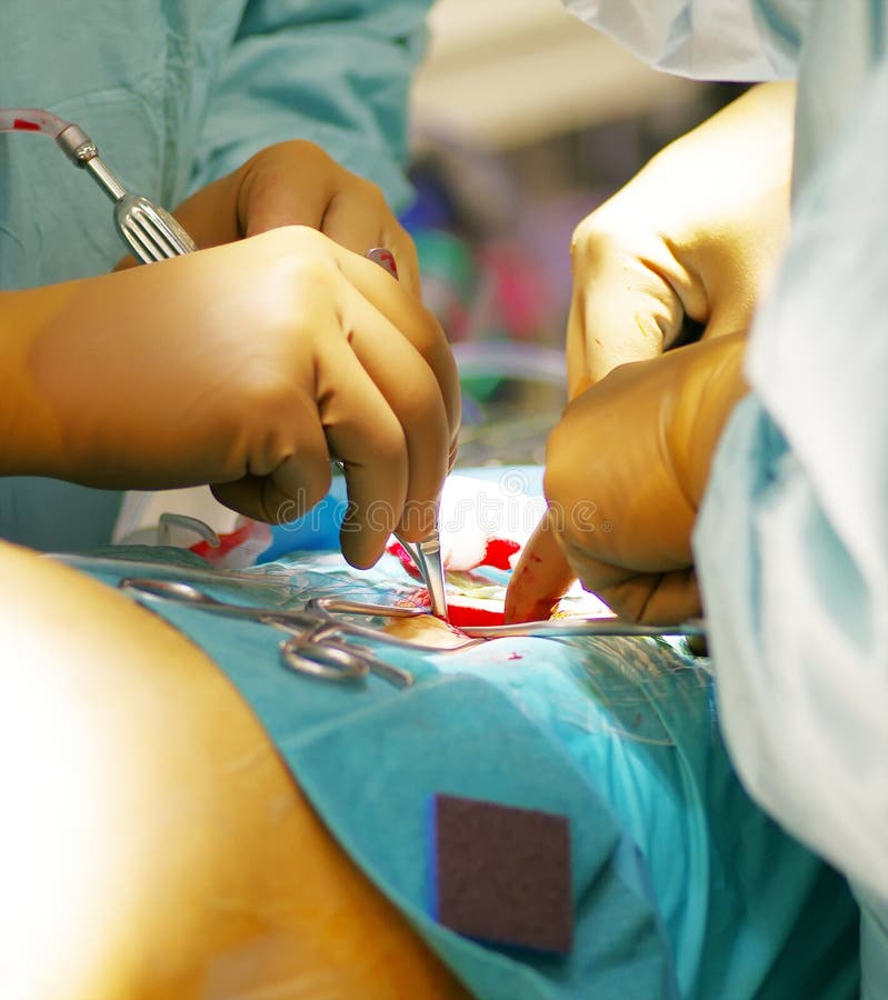 Hand surgeons stock photo. Image of glove, hospital, operation - 41274408