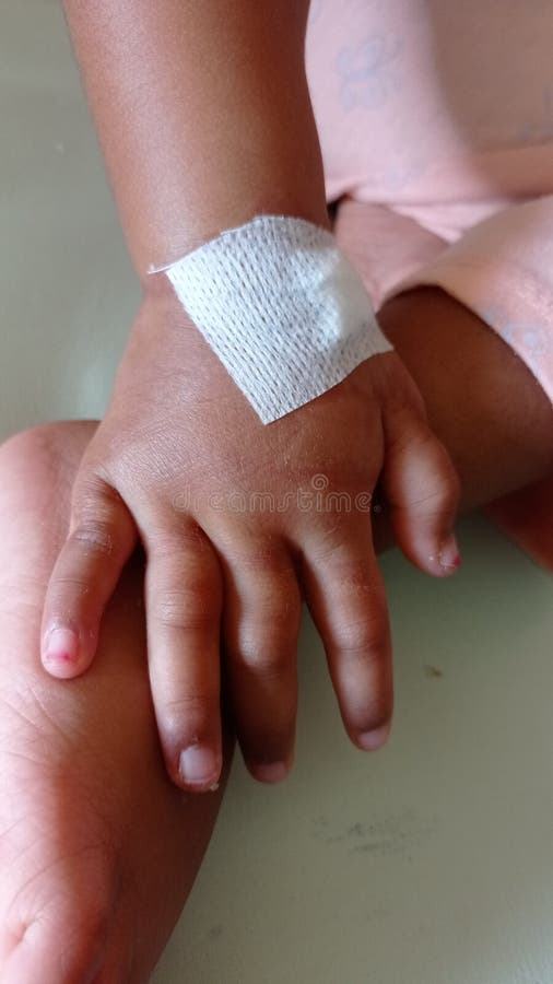 Hand swollen from infusion stock photo. Image of hand - 261839138
