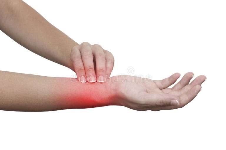 Radial Artery Complications Stock Photos - Free & Royalty-Free Stock ...