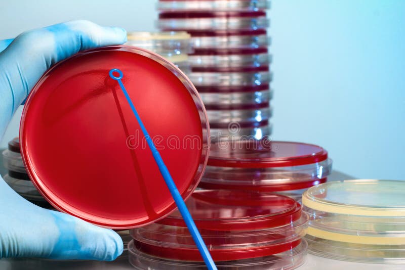 The inoculating loop stock image. Image of biological - 158135695