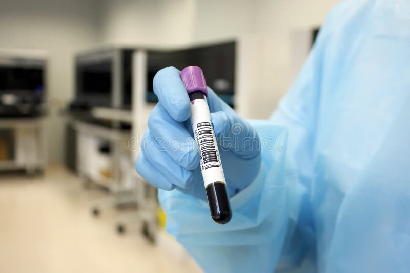 Hand with Test Tube of Blood Stock Image - Image of hand, group: 61808489