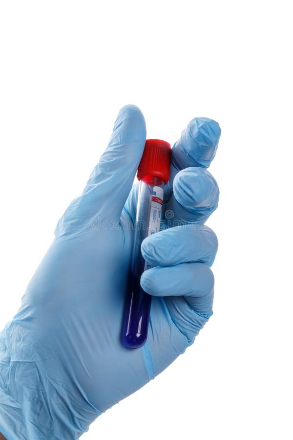 Hand with a test tube stock photo. Image of exam, infirmary - 55239300