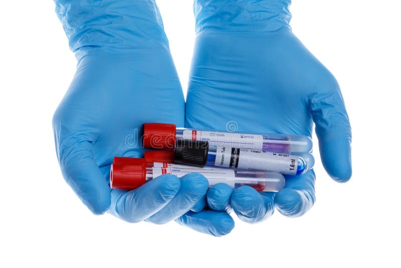 Hand with a test tube stock photo. Image of exam, infirmary - 55239300