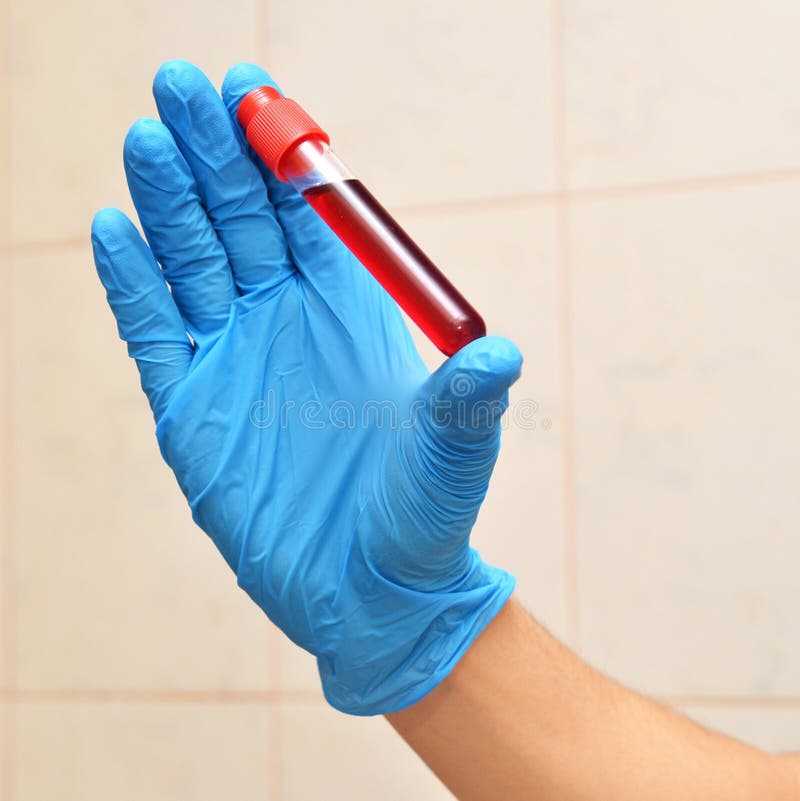 Hand with Testing Tube Full of Blood Stock Photo - Image of discovery ...