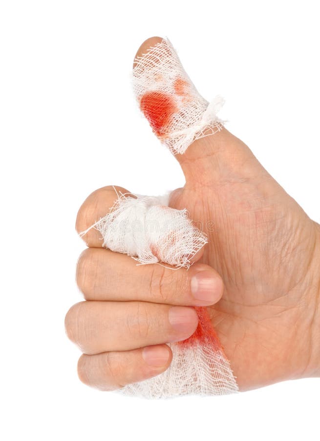 541 Injured Hand Cut Blood Photos - Free & Royalty-Free Stock Photos ...