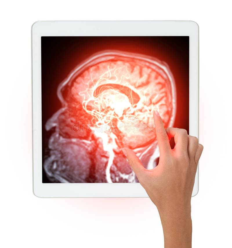 A Hand Touches a Tablet Screen Displaying a Brightly Highlighted MRI ...