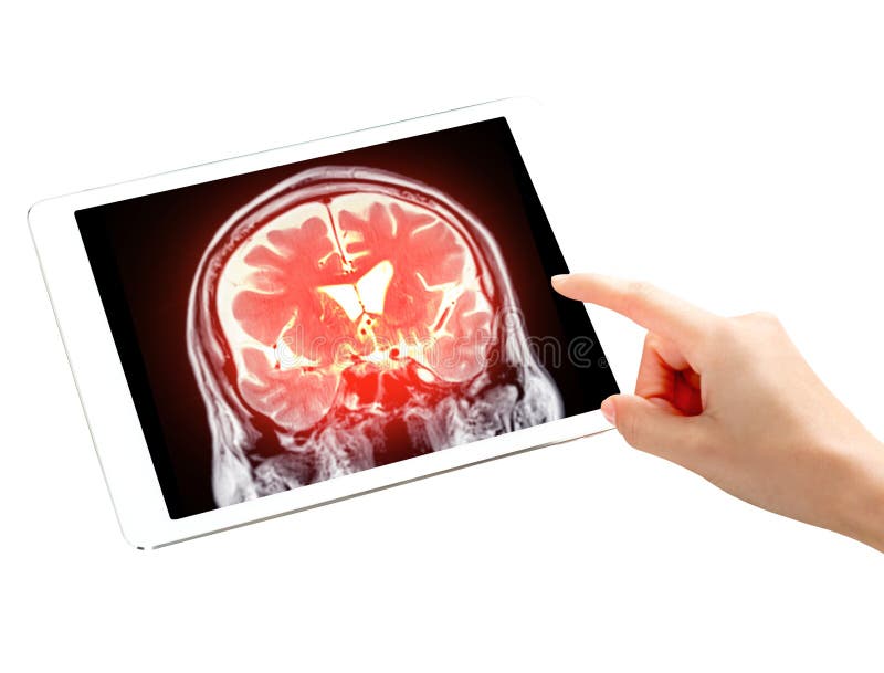 A Hand Touches a Tablet Screen Displaying a Brightly Highlighted MRI ...