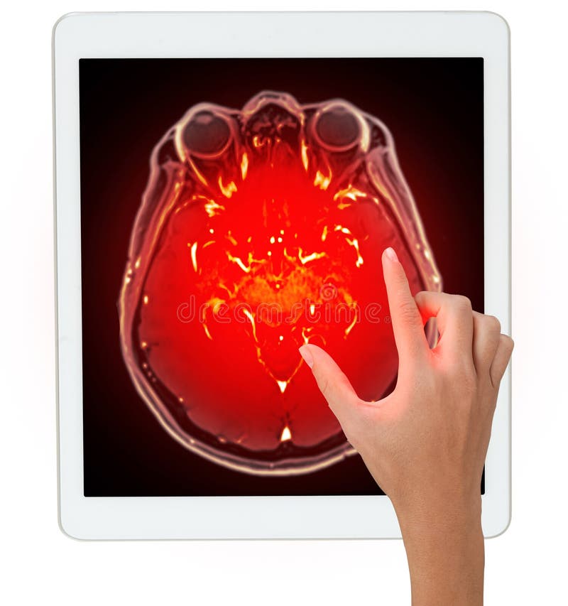 A Hand Touches a Tablet Screen Displaying a Brightly Highlighted MRI ...