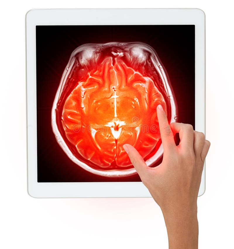 A Hand Touches a Tablet Screen Displaying a Brightly Highlighted MRI ...