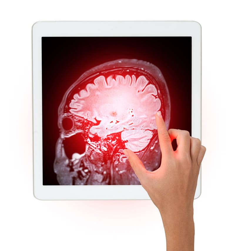 A Hand Touches a Tablet Screen Displaying a Brightly Highlighted MRI ...