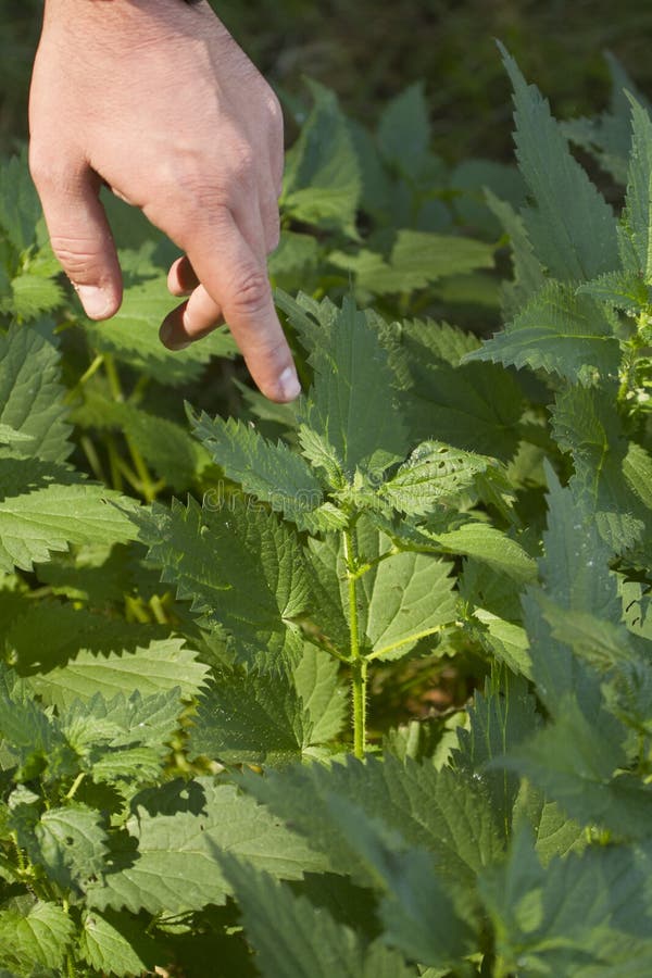 Stinging Nettle Rash On Hand