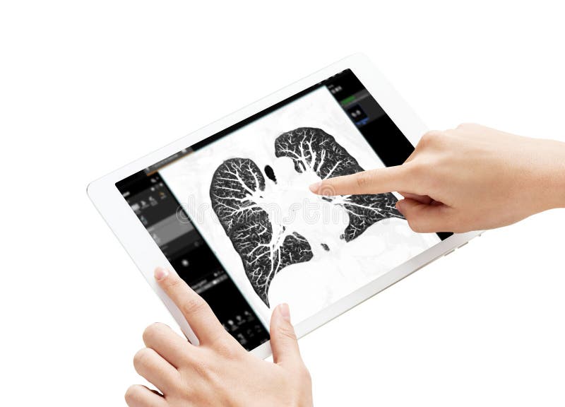 Hand Touching Tablet Display of CT Chest Scan Shown on a Tablet Screen ...
