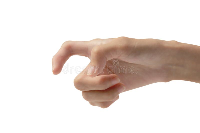 Hand Was Bent Due To a Bone Problem Isolated on White Background with ...
