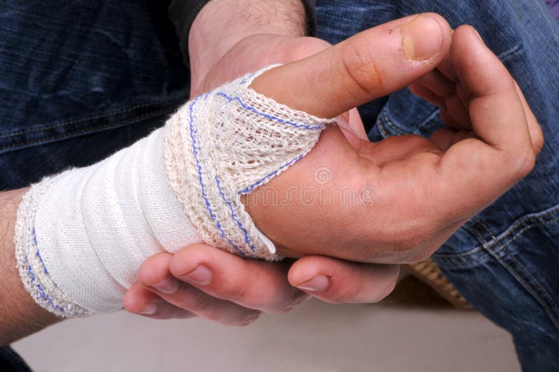 Wounded Hand Stock Photos - Download 1,796 Royalty Free Photos