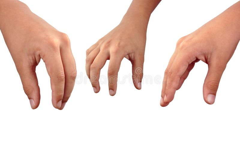 Deformed hands stock photo. Image of people, medical - 16211826