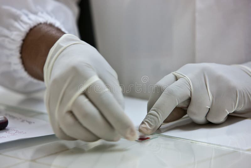 Hands of Doctor Holding Blood Test Plates. Stock Image - Image of ...