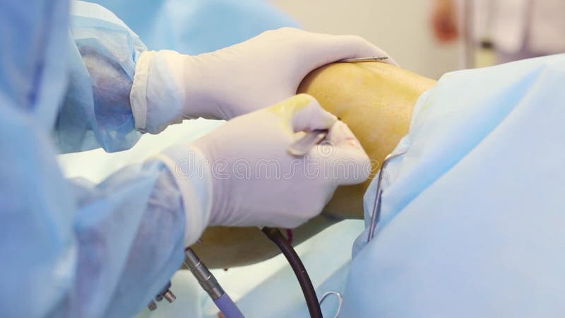 Hands of Doctor Making Cut for Endoscope Surgery Stock Video - Video of ...