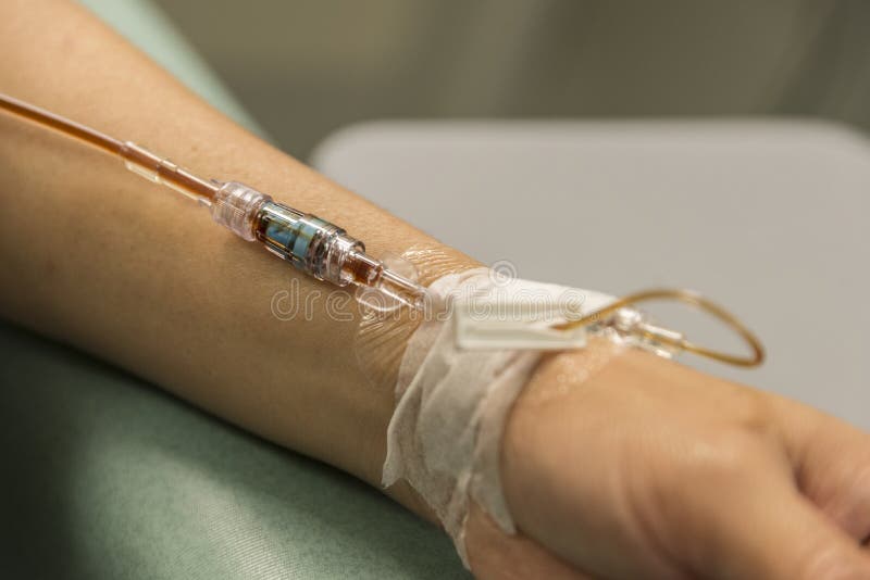 Hands with IV stock image. Image of life, adult, healthcare - 70660917