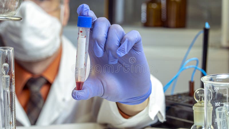 Hands of a Lab Technician with a Tube of Blood Sample and a Rack with ...