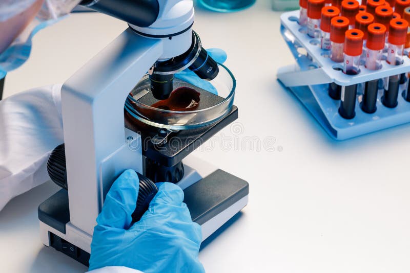 Hands of a Laboratory Worker Doing Blood Test Stock Image - Image of ...