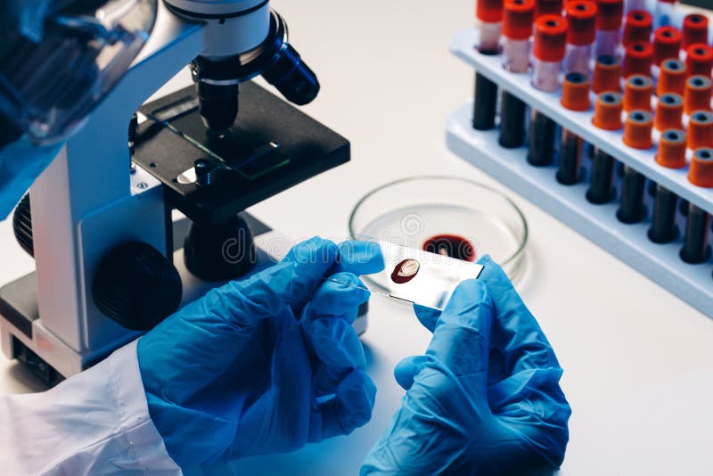 Hands of a Laboratory Worker Doing Blood Test Stock Photo - Image of ...