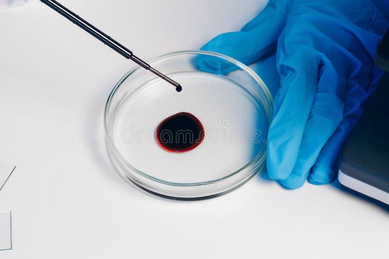 Hands of a Laboratory Worker Doing Blood Test Stock Photo - Image of ...