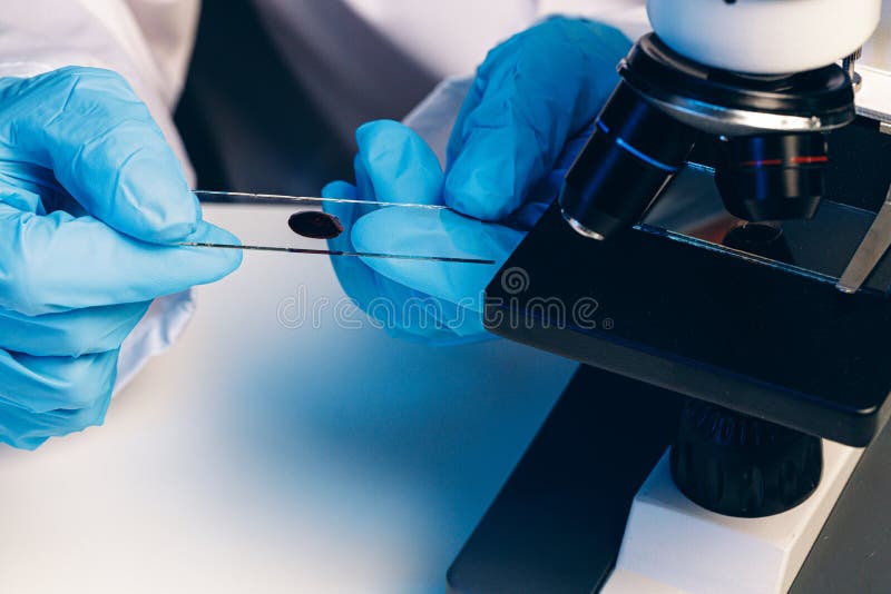 Hands of a Laboratory Worker Doing Blood Test Stock Image - Image of ...