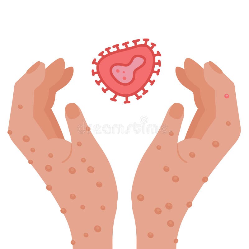 Rash Holding Virus Cell Stock Illustrations – 5 Rash Holding Virus Cell ...
