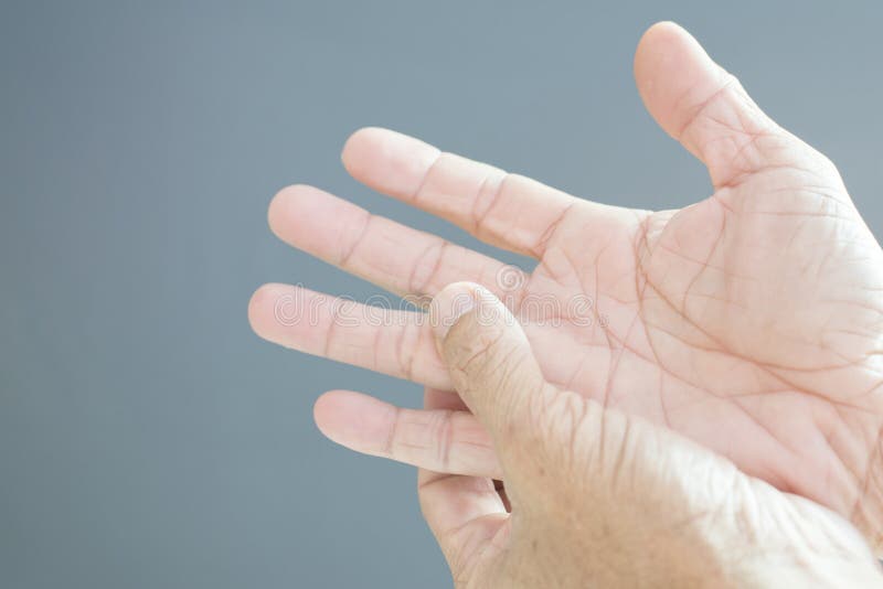 The Hands of People Who Have Problems with the Finger Bone Stock Image ...