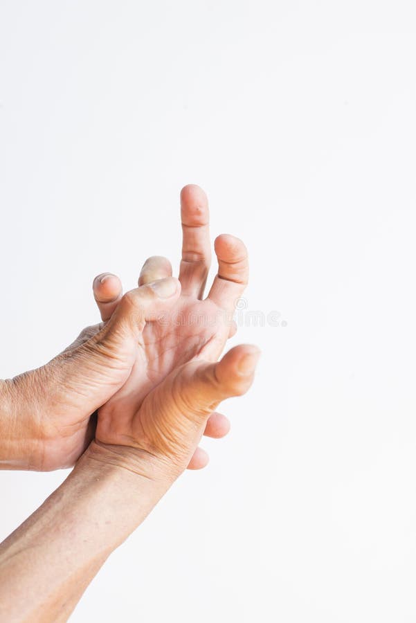 Hands with Problems of Deterioration of the Bones of the Fingers Stock ...