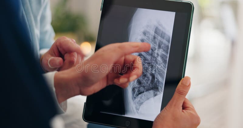 Hands, X Ray and Team of Doctors on Tablet, Discussion and Planning in ...