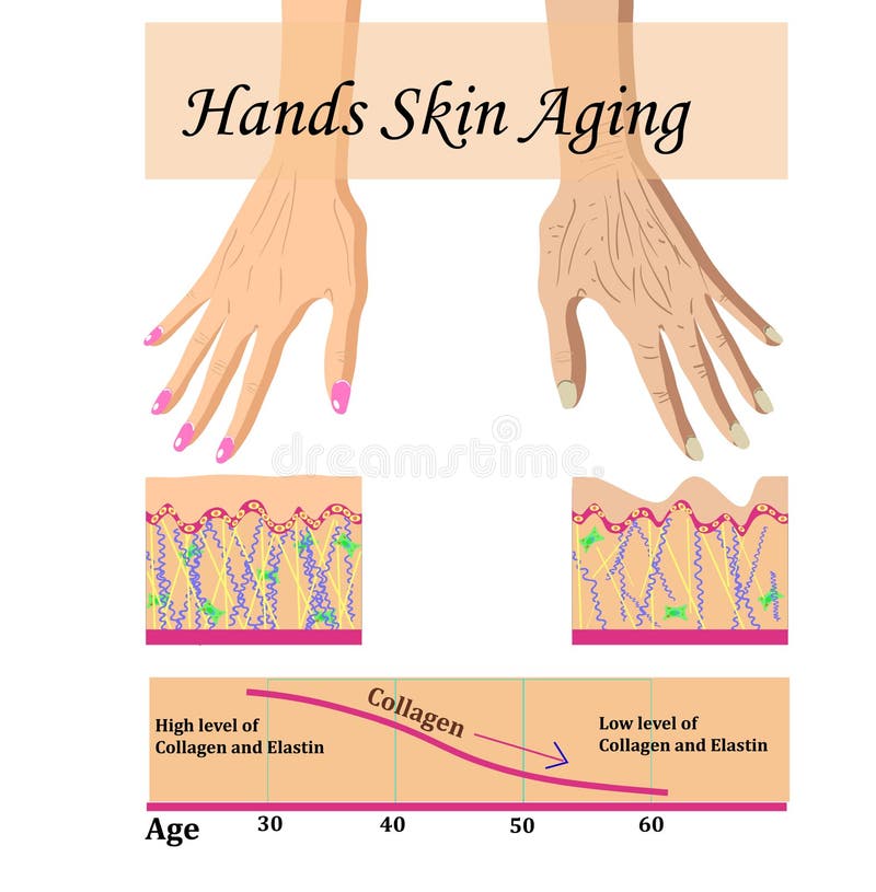 Skin aging stock vector. Illustration of layers, medicine - 78505804