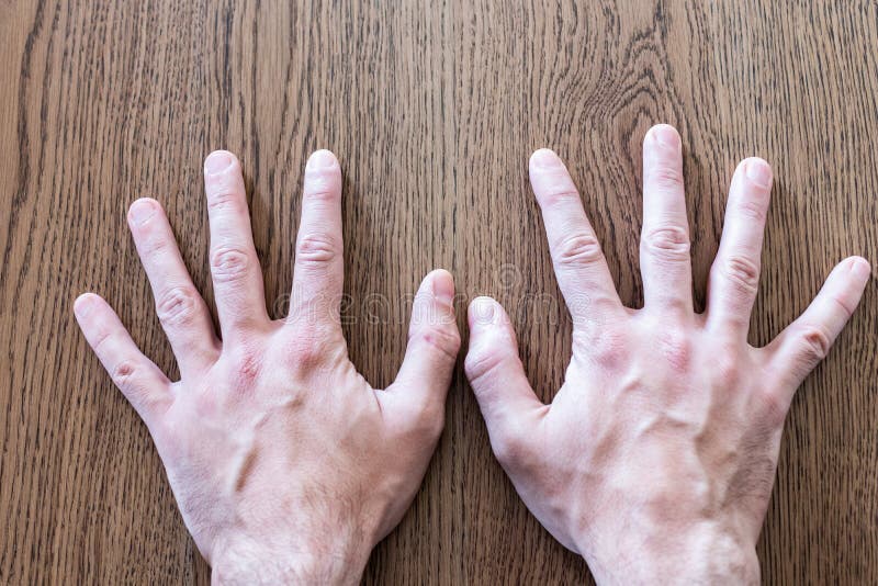 Hands on Table in a Pose To Simulate Holding Something. Hands Open and ...