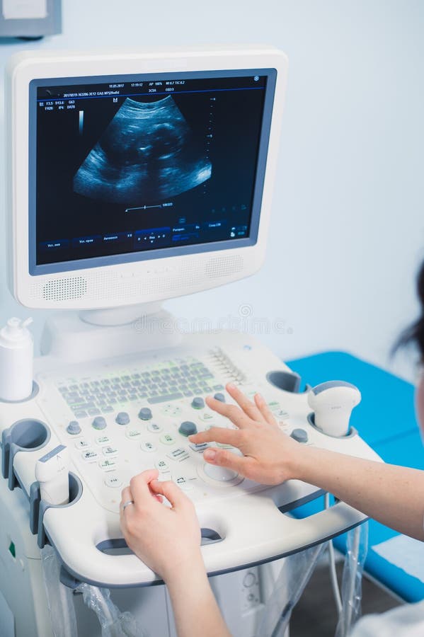 Ultrasound Machine, Doctor`s Hand Usg Investigation USCG Stock Image ...