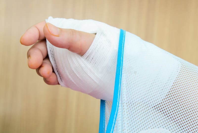 Handverletzung stockfoto. Bild von behandlung, notfall - 38681548