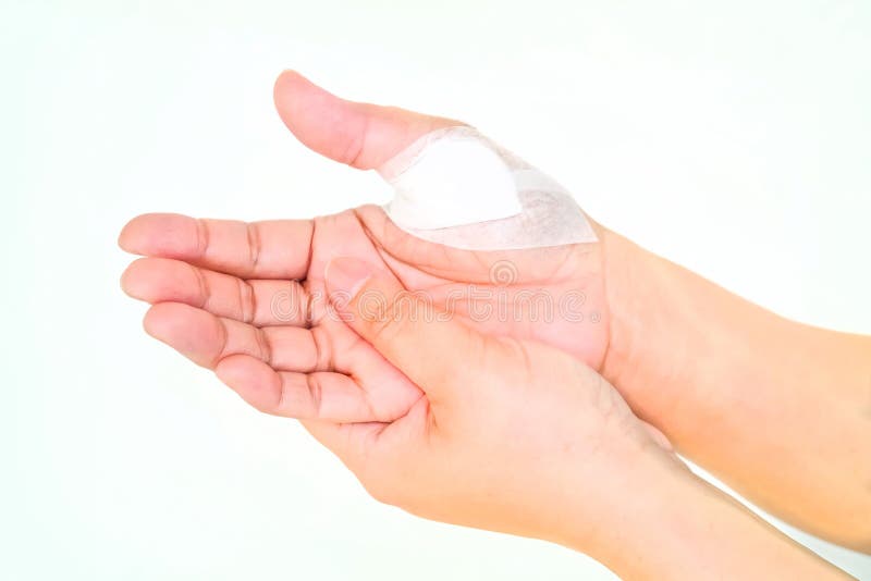 Handverletzung stockfoto. Bild von verletzung, hilfsmittel - 39420898