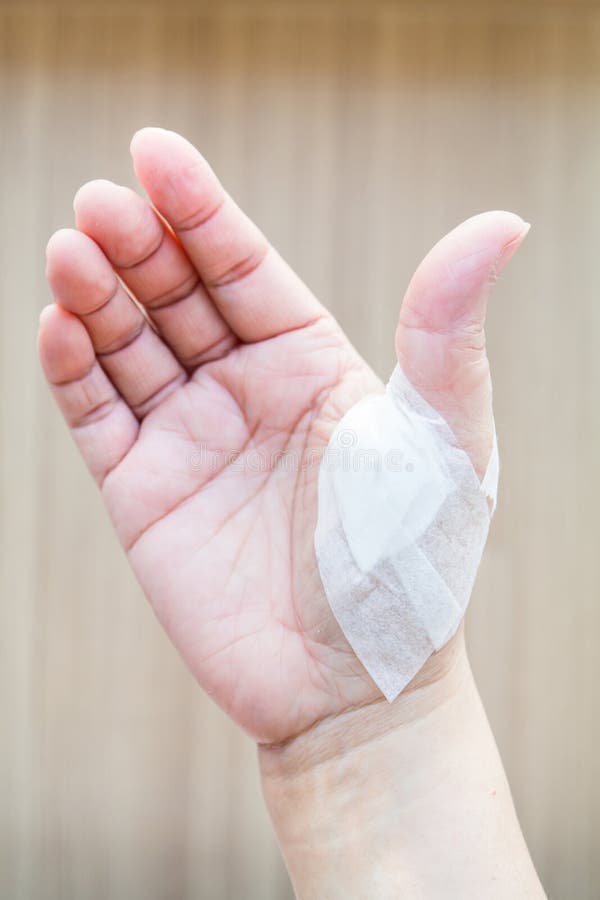 Handverletzung stockbild. Bild von notfall, verletzt - 39420981