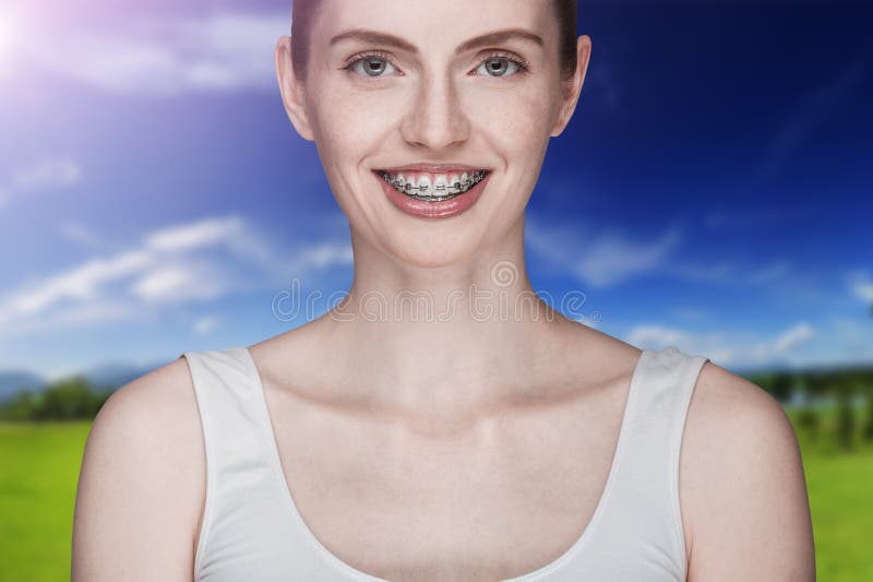 419 Overbite Person Stock Photos - Free & Royalty-Free Stock Photos ...
