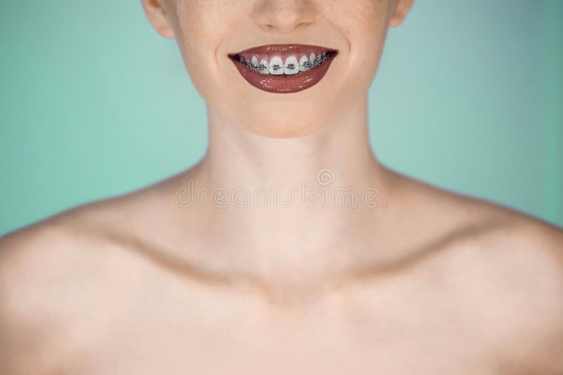 121 Turquoise Braces Stock Photos - Free & Royalty-Free Stock Photos ...