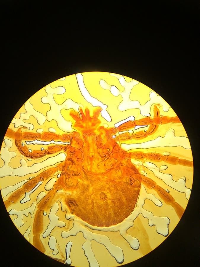 Microscope - Tick (Rhipicephalus Sanguineus) Stock Photo - Image of ...
