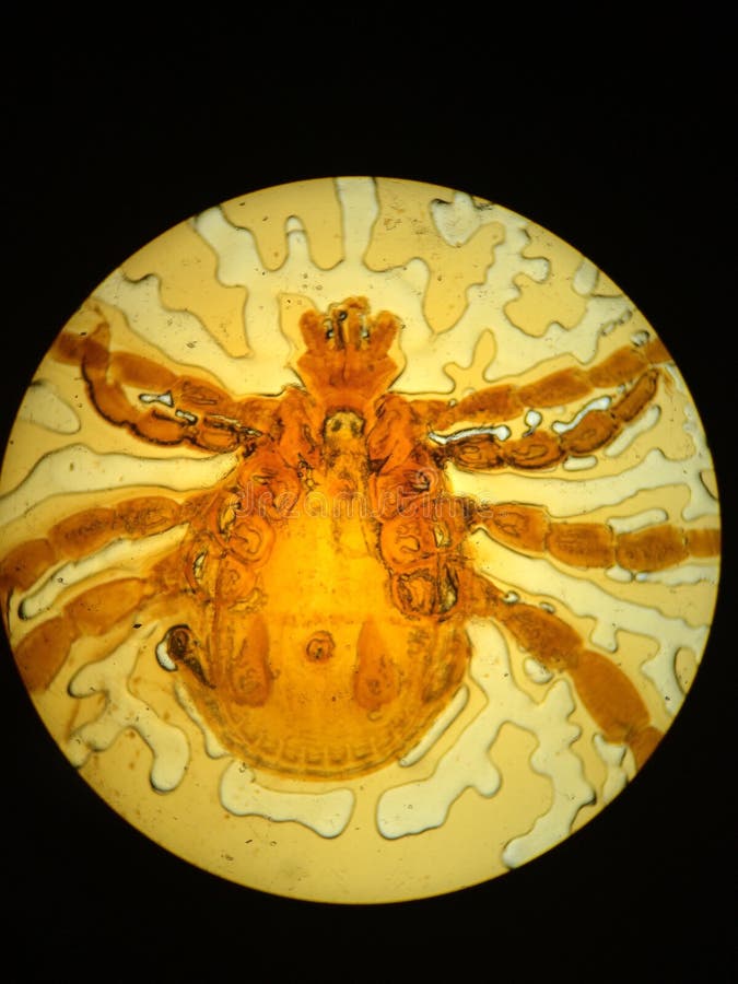 Deer Tick Under Microscope