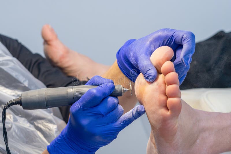 Hardware Pedicure, Sanding the Foot with an Abrasive Disc Stock Photo ...