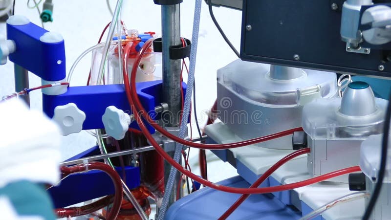 Hart-long Machine Voor Hartchirurgie Stock Video - Video of beroep ...