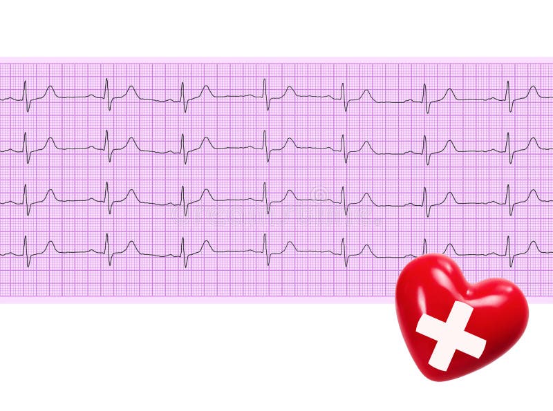 Hartanalyse, Elektrocardiogram Grafiek En Rood Hart (ECG) Stock Foto ...