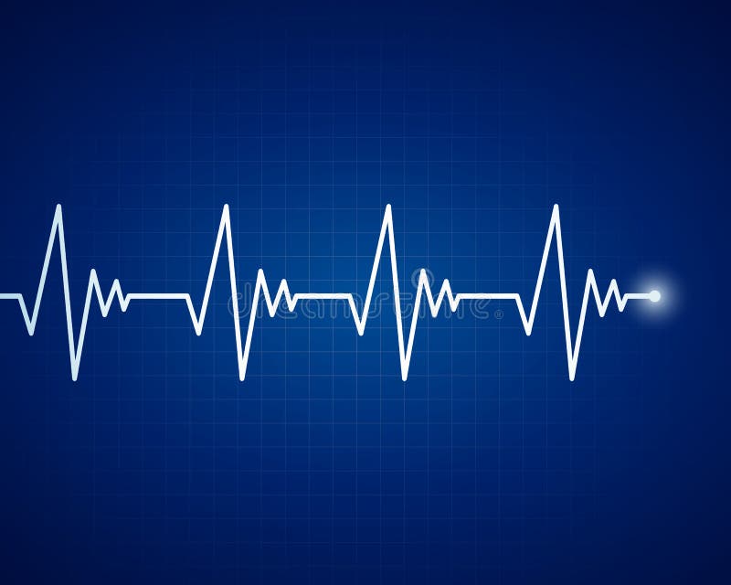 Hartfrequentie stock illustratie. Illustration of examen - 30489464