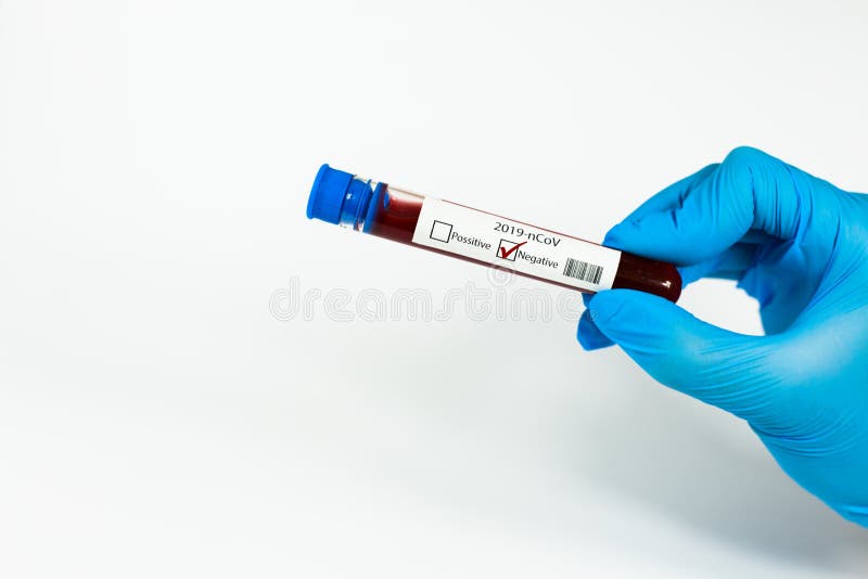 Blood Test Samples for Presence of Coronavirus COVID-19 Tube Containing ...