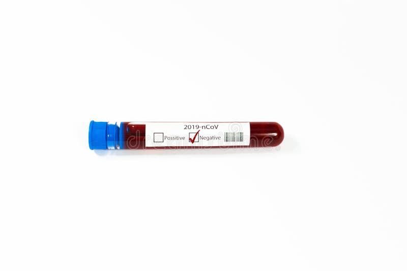 Blood Test Samples for Presence of Coronavirus COVID-19 Tube Containing ...