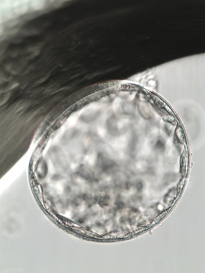 Hatched Human Blastocyst. Grade BA. on the Fifth Day of Development ...