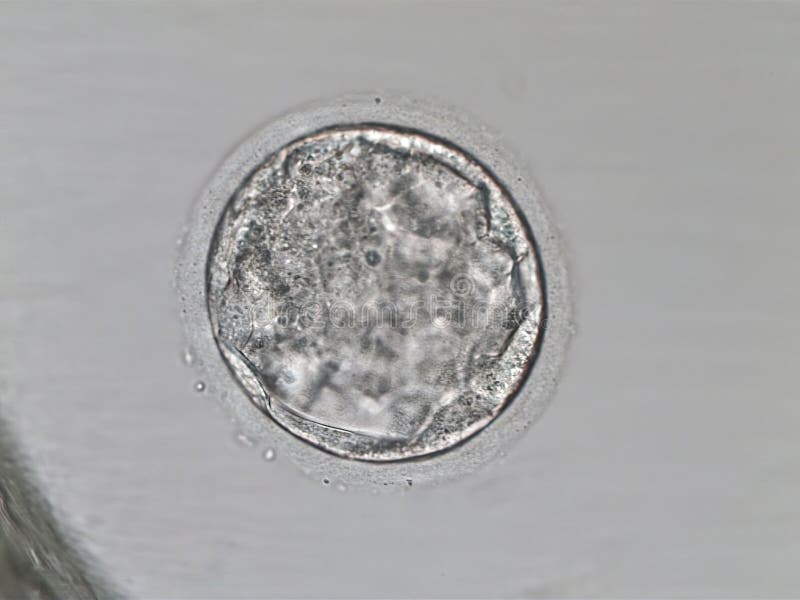 Hatched Human Blastocyst. Grade CB. on the Fifth Day of Development ...